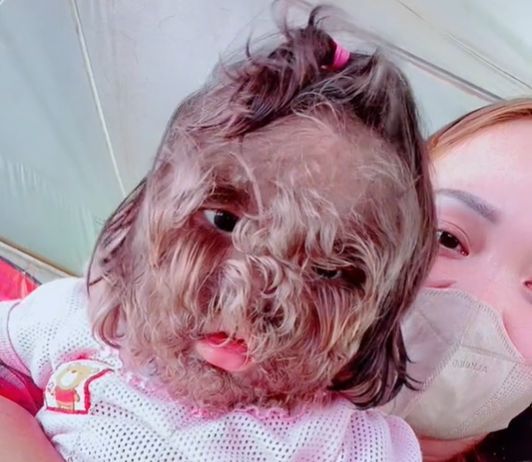 Pielęgniarka zemdlała na porodówce. Przestraszyła się wyglądu dziecka