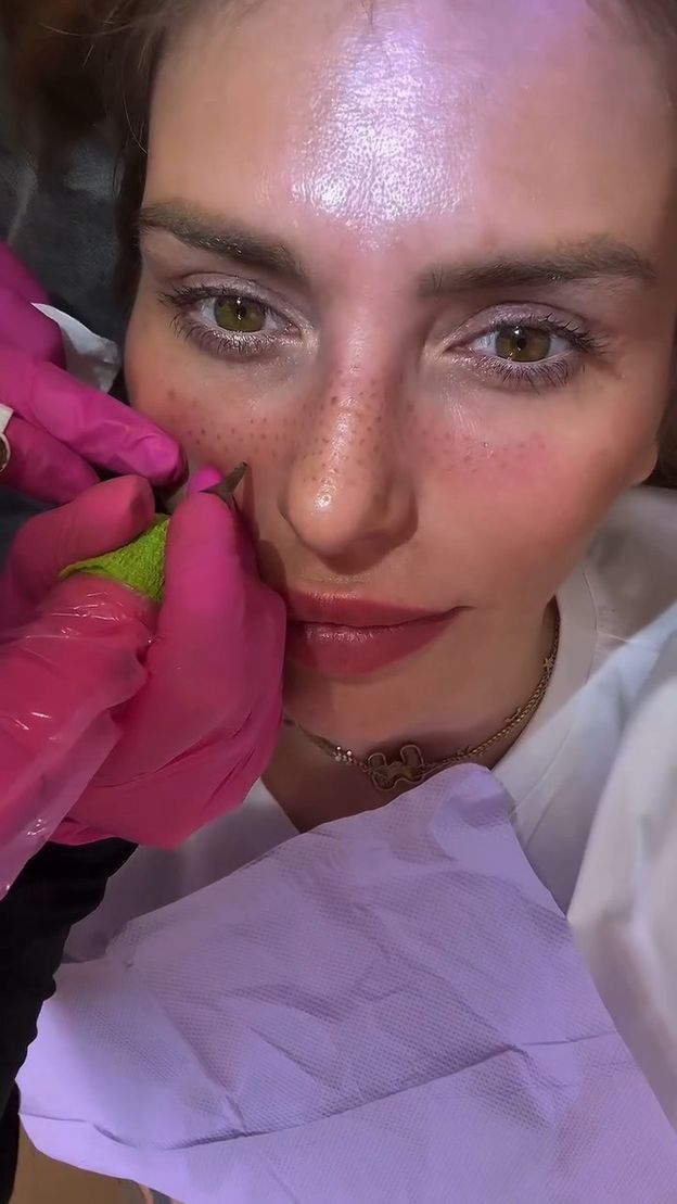 Monika Goździalska ozdobiła twarz piegami permanentnymi. Internauci są ...