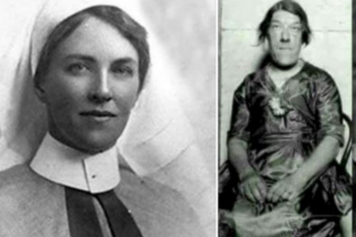 "Najbrzydsza kobieta świata". Dramatyczna historia Mary Ann Bevan - WP ...