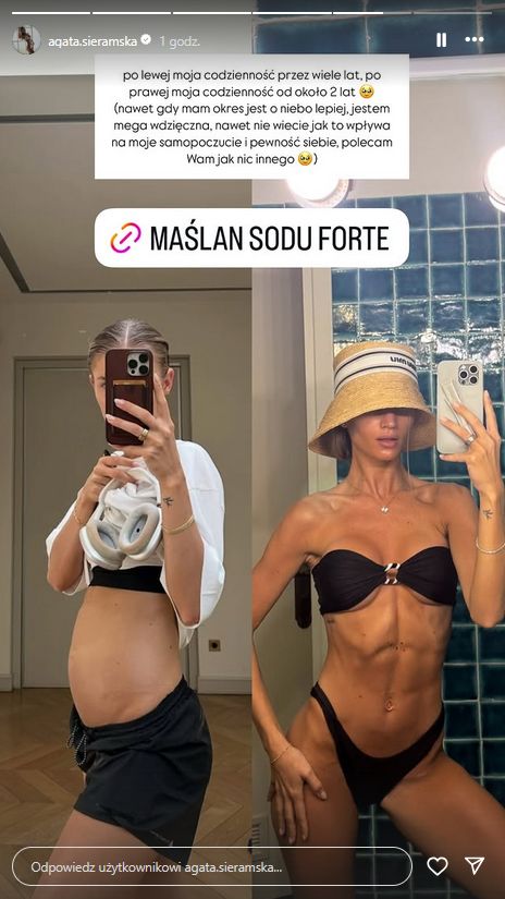 Na to choruje Sieramska. Pokazała zdjęcie brzucha - Pudelek