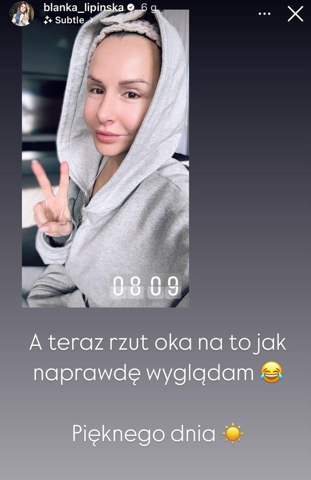 Blanka Lipińska pokazała się po liftingu twarzy - Pudelek