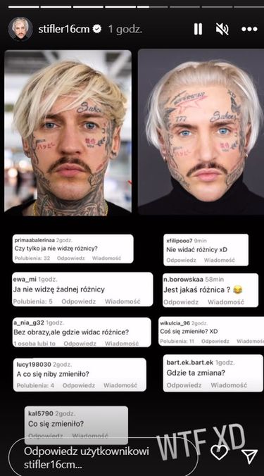 Stifler przeszedł serię operacji plastycznych. Tak wyglądał chwilę po ...