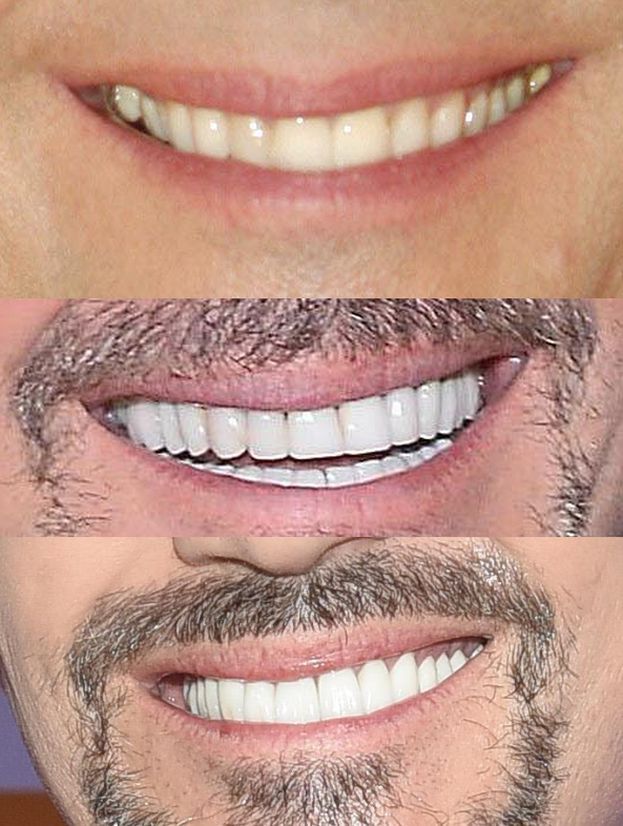 Nowe, białe zęby Krzysztofa Ibisza pozdrawiają z ramówki Polsatu ...