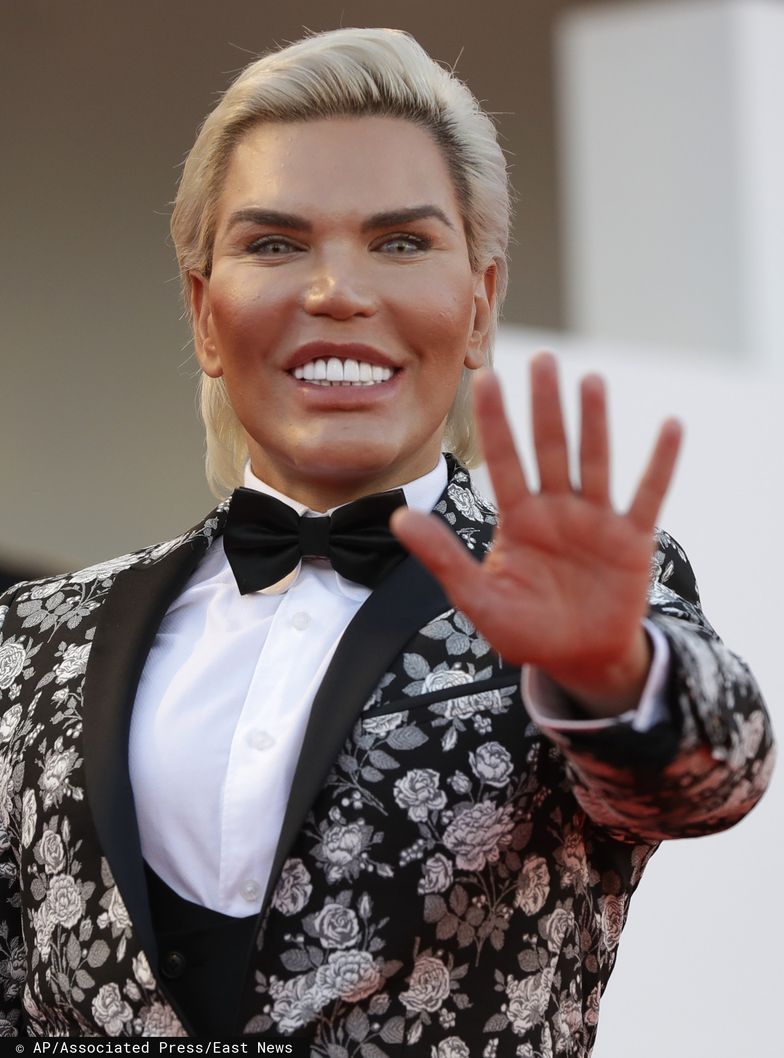 "Żywy Ken" Rodrigo Alves miał ponad 100 operacji, ale żałuje tylko ...