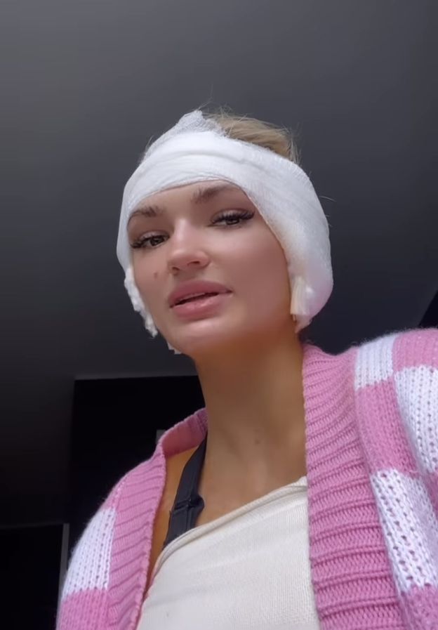 Aleksandra Daniel z "Love Island" relacjonuje operacje PIERSI I USZU ...
