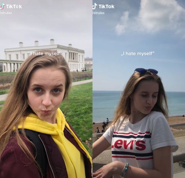 Dziewczyna Fabijańskiego ma powiększone usta! Tak kiedyś wyglądała ...