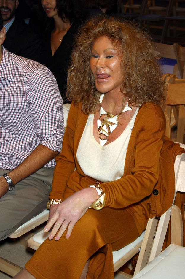 "Kobieta Kot" twierdzi, że nie przeszła żadnej operacji plastycznej ...