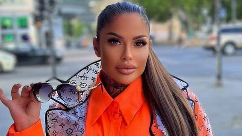 Laluna Unique prezentuje NOWĄ TWARZ bez opatrunków po kolejnej operacji ...