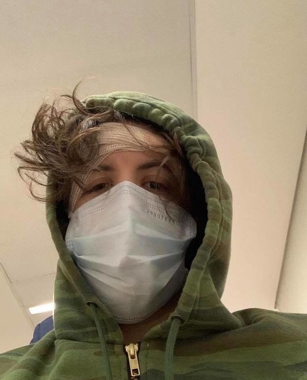 21-letni syn Micka Jaggera pokazał na Instagramie OPERACJĘ UCHA ...