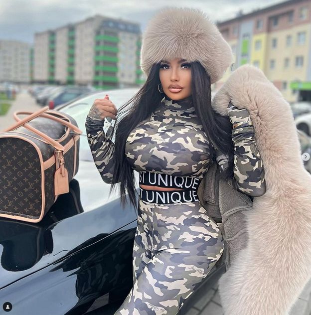 Laluna Unique pokazała efekty kolejnych operacji. Tak teraz wygląda ...