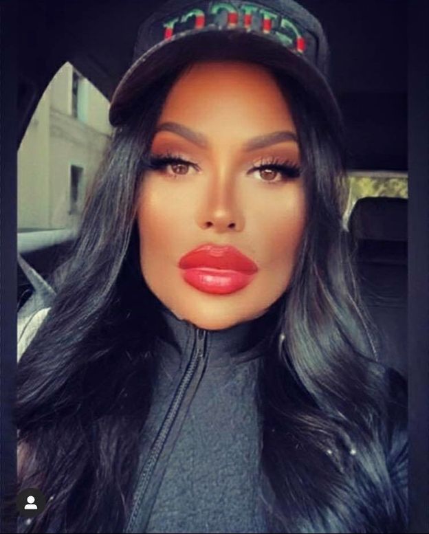 Laluna Unique z "Królowych Życia" ekscytuje się ODSYSANIEM TŁUSZCZU w ...