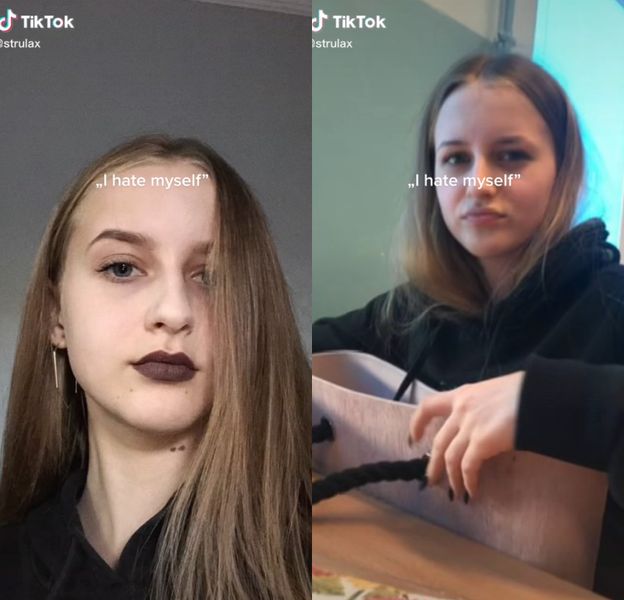 Dziewczyna Fabijańskiego ma powiększone usta! Tak kiedyś wyglądała ...