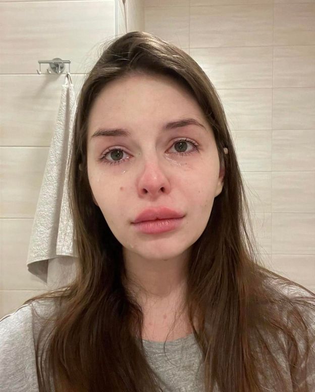 Wiktoria Cwynar zapadła na tajemniczą chorobę: "Na ciele pojawiały się rany i krwiaki ...