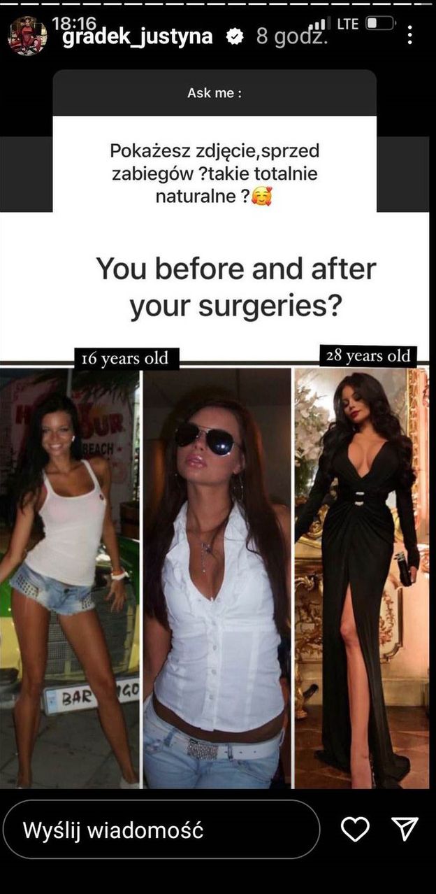Tak Justyna Gradek wyglądała przed OPERACJAMI! Pochwaliła się zdjęciem sprzed 13 lat. Poznajecie ...