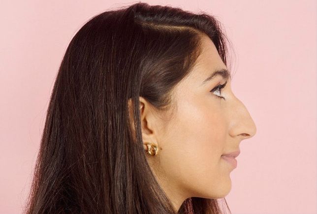 Wstydzisz się "za dużego" nosa? Nie jesteś sama. Ta dziennikarka ...