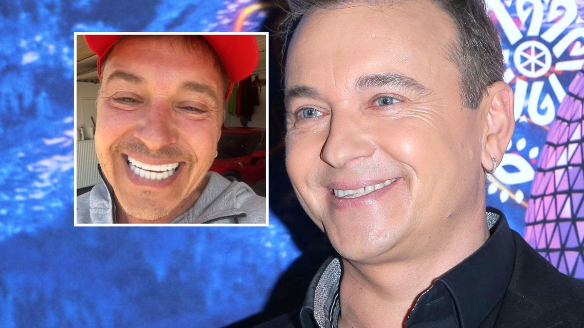 Radek Liszewski krytykowany za nowe zęby. Wydał na nie fortunę