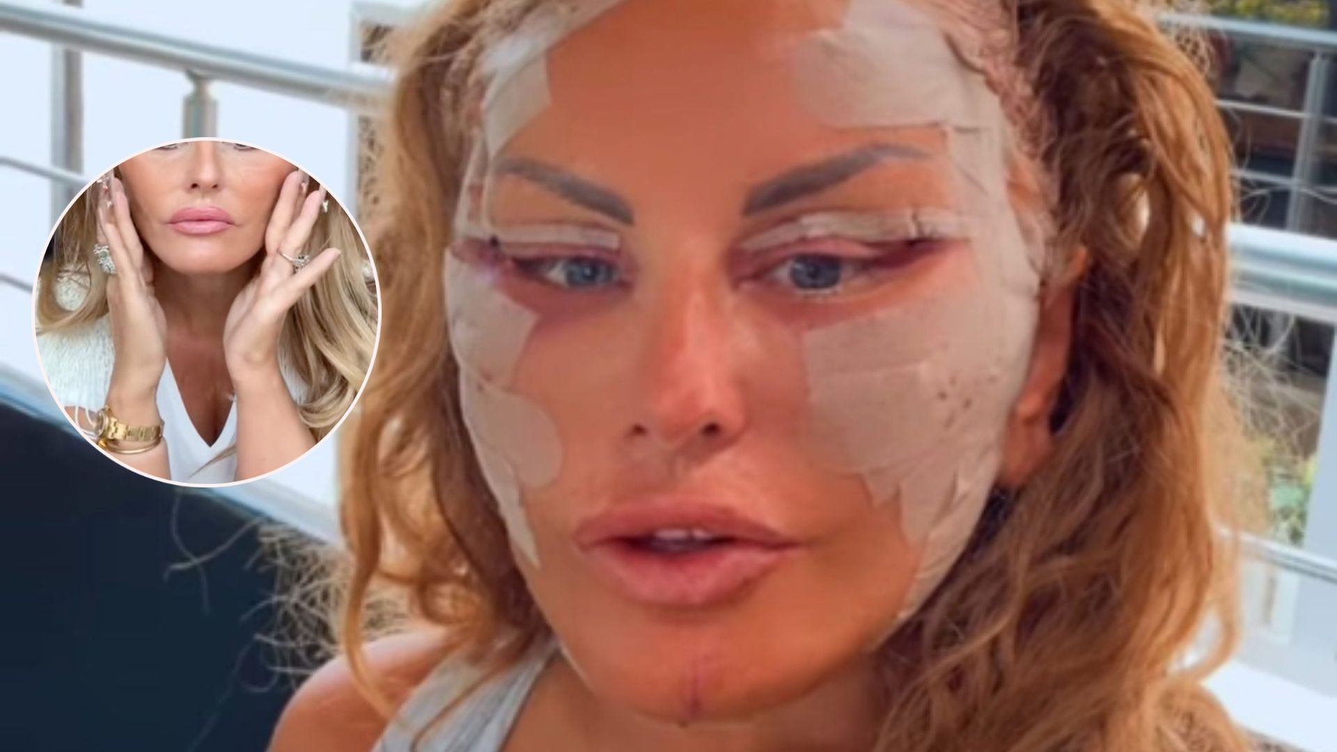 Dagmara Kaźmierska przeszła lifting twarzy. Pokazała, jak teraz wygląda