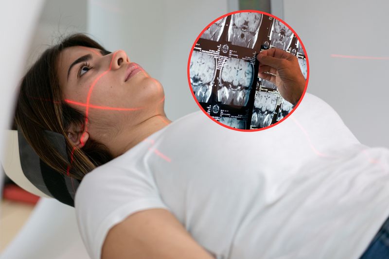 Guz mózgu. Naukowcy wskazują cztery możliwe objawy