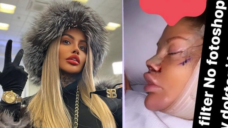 Laluna Unique ujawnia, ILE WYDAŁA na operacje plastyczne! Kwota zwala z ...