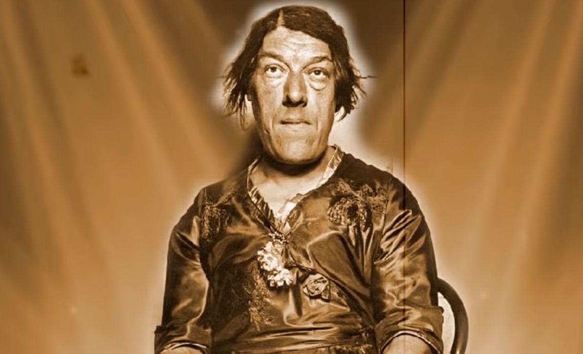 Zdobyła tytuł "najbrzydszej kobiety na świecie". Smutna historia Mary ...