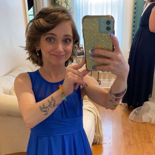 Ma 23 lata, ale wygląda na 8. To efekt operacji - Pudelek