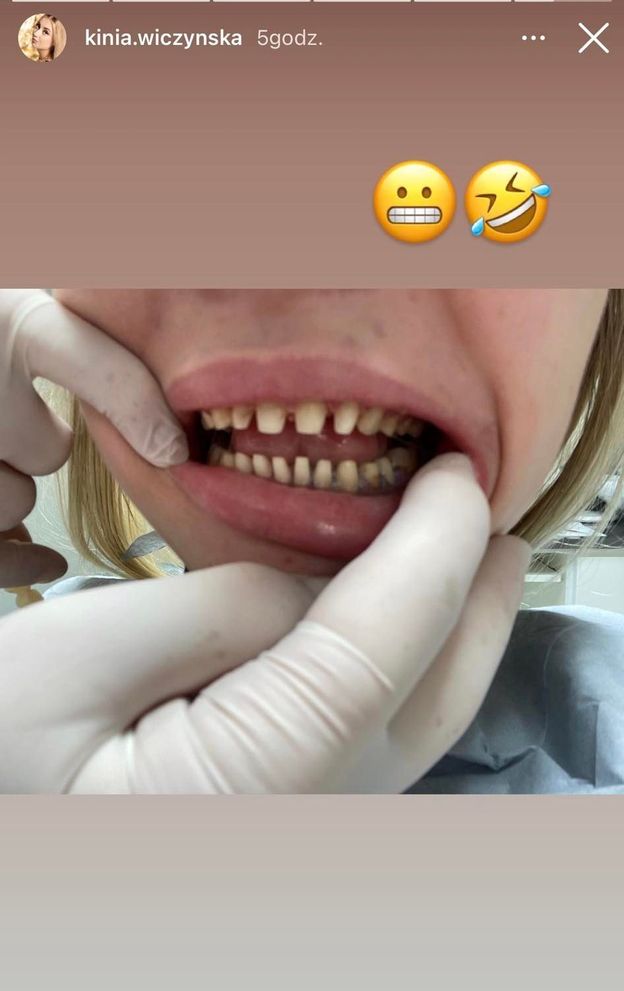 Tiktokerka Kinia Wiczyńska prezentuje NOWE ZĘBY! Pokazała też, jak ...