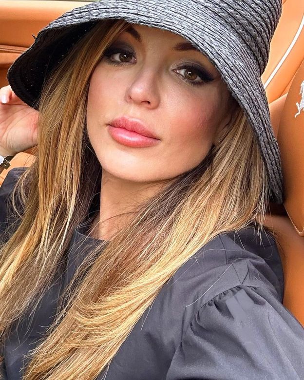 Oblano modelkę kwasem. Pokazała, jak teraz wygląda jej twarz - Pudelek