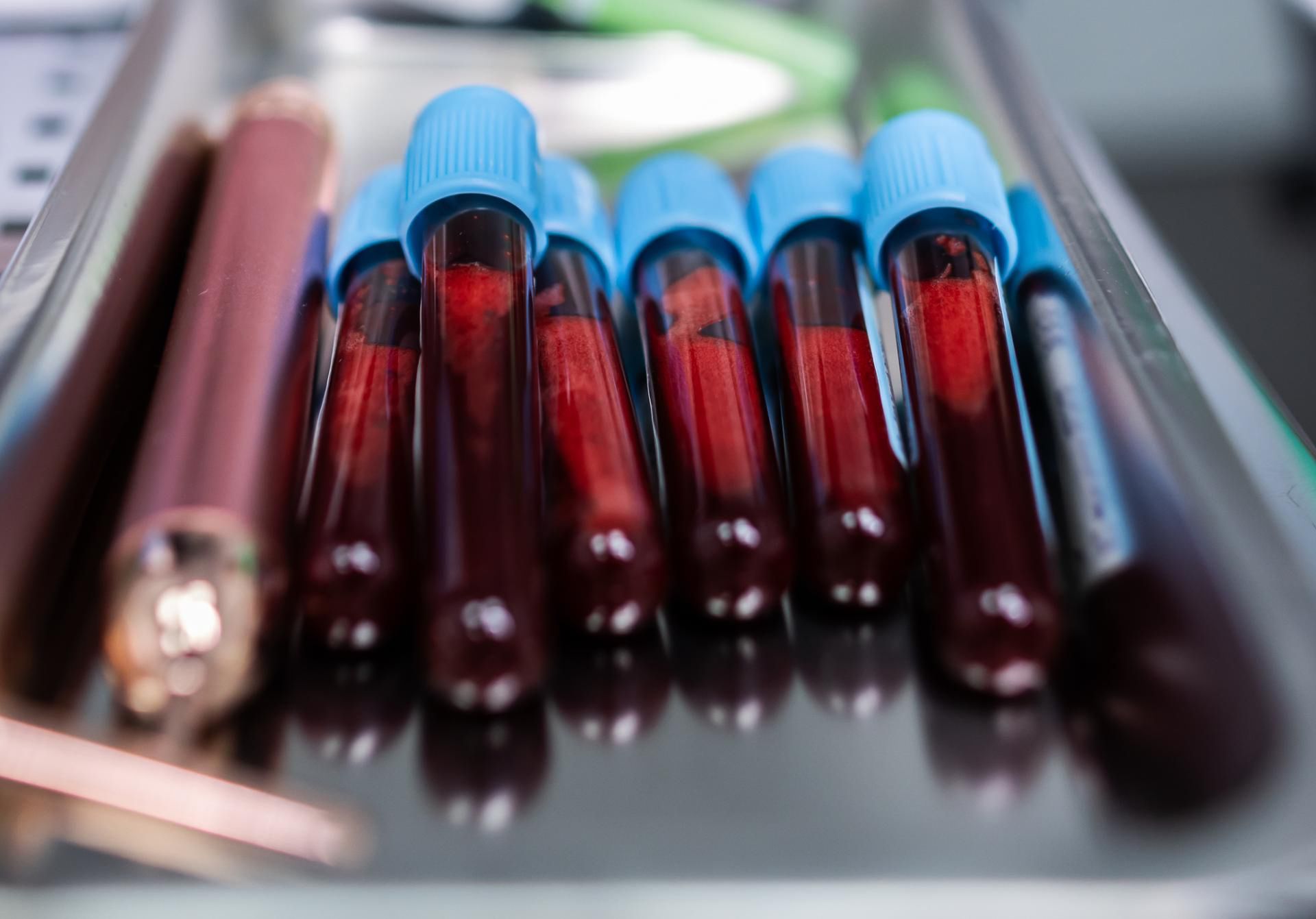 Wystarczy kropla krwi. Test wykrywa choroby w 15 minut