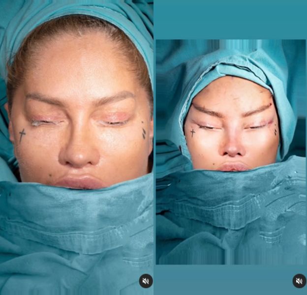 Laluna Unique pokazała efekty kolejnych operacji. Tak teraz wygląda ...