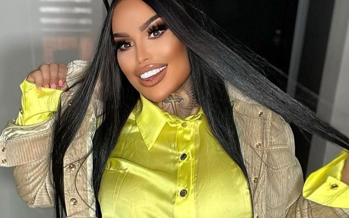 "Królowa życia" już tak nie wygląda. Laluna Unique po operacji twarzy ...