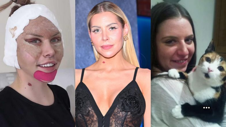 Julia von Stein zafundowała sobie lifting twarzy. Pamiętacie, jak KIEDYŚ wyglądała? - Pudelek