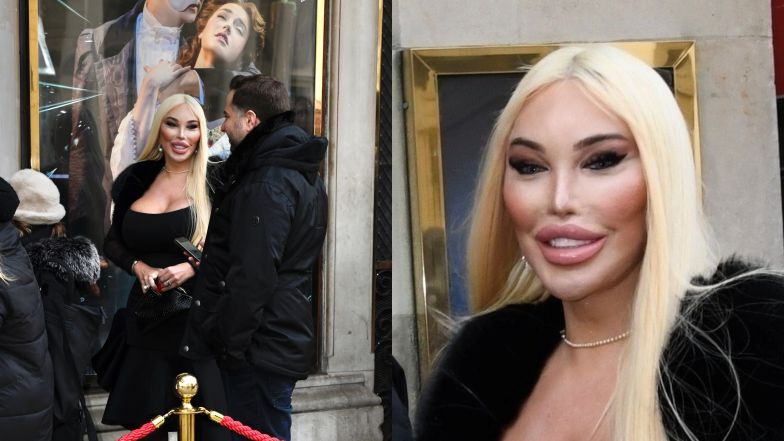 Jessica Alves zrobiła sobie ponad 100 operacji. Tak dziś wygląda - Pudelek