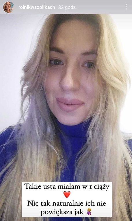 Małgorzata Borysewicz dementuje plotki o ustach. Pokazała zdjęcie - Pudelek