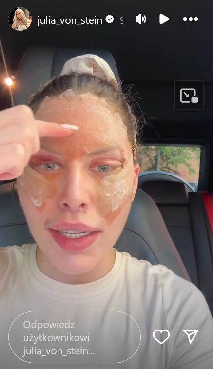 Julia von Stein wymienia, co sobie poprawiła liftingiem twarzy - Pudelek