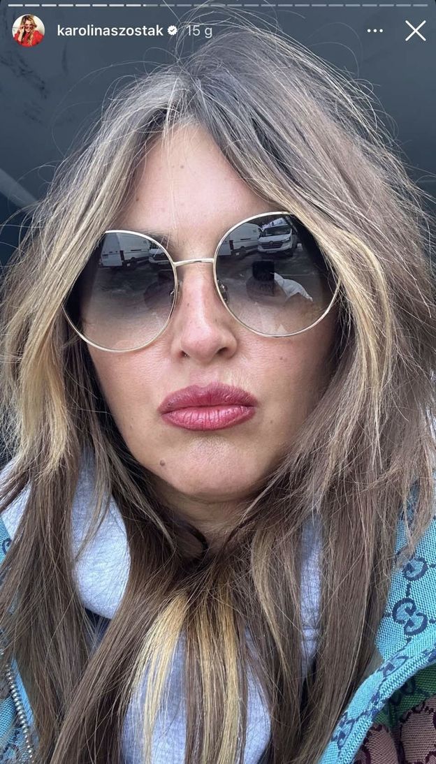 Pozbawiona FILTRÓW Karolina Szostak publikuje w sieci nieprzerobione zdjęcia - Pudelek