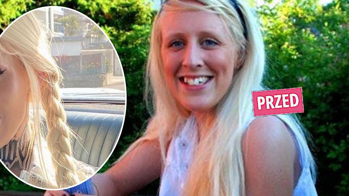 Alicia Amira wydała pół miliona na operacje plastyczne, by upodobnić ...