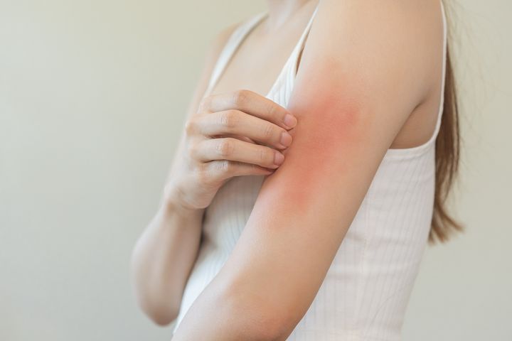 Locoid - skład, działanie, wskazania, przeciwwskazania, skutki uboczne ...