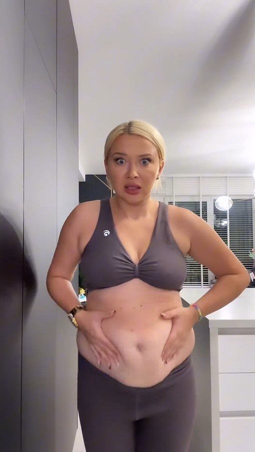 Przeszła plastykę brzucha. Pokazała skórę po 4 miesiącach - Pudelek