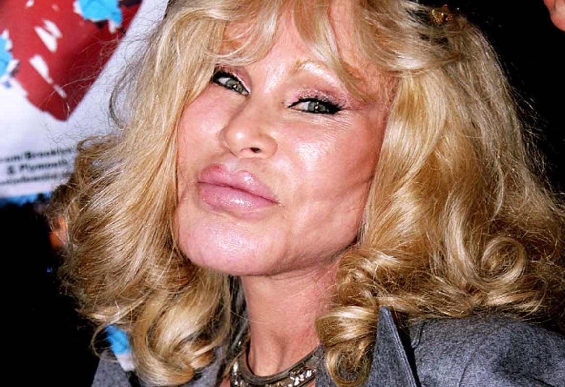 Jocelyn Wildstein znana jako "Kobieta-Kot" zarobiła krocie na rozwodzie ...