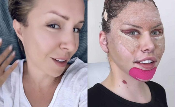 Julia von Stein demonstruje efekty liftingu: "Uszy w porządku? Żeby nie było jak u Lipińskiej ...