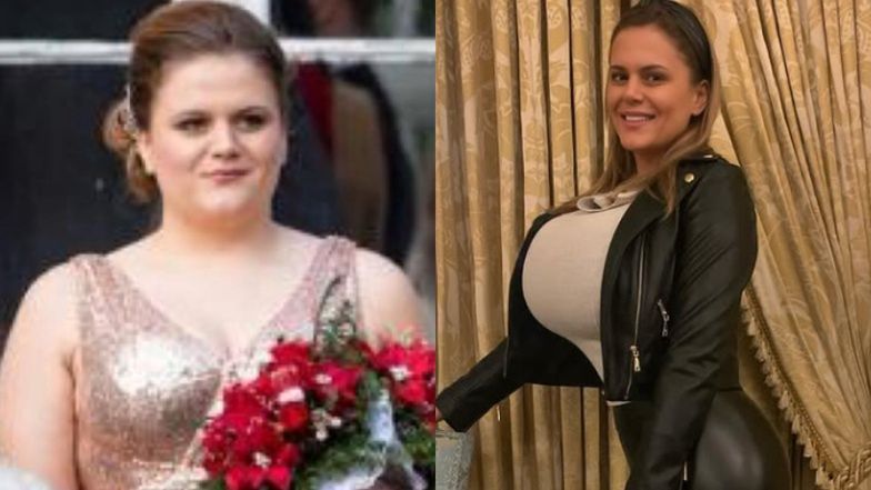 Wyśmiewali się z jej wyglądu. Kobieta wydała 150 tys. zł na metamorfozę