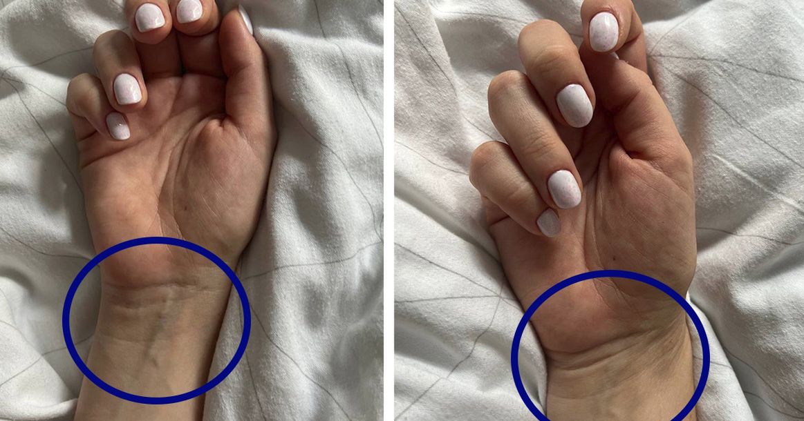 Masz tę linię na nadgarstku? Sprawdź, co oznacza - WP Kobieta