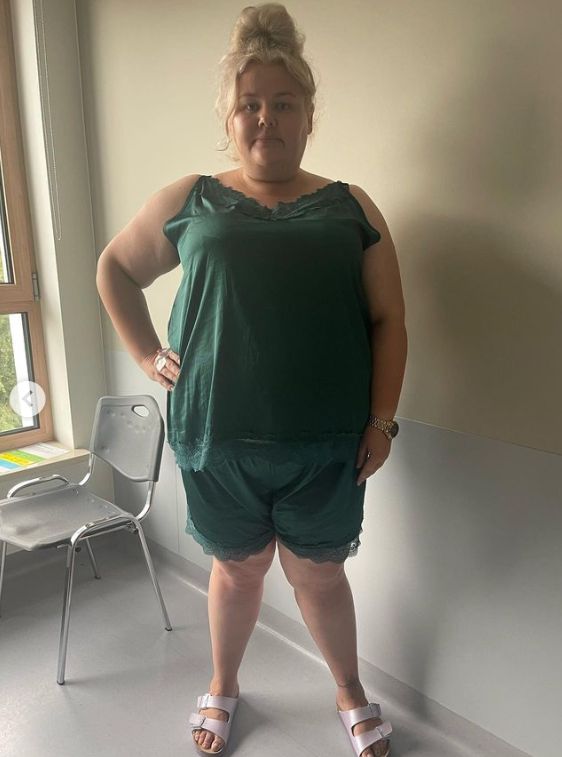 Przeszła operację zmniejszenia żołądka. Pokazała zdjęcia ze szpitala ...