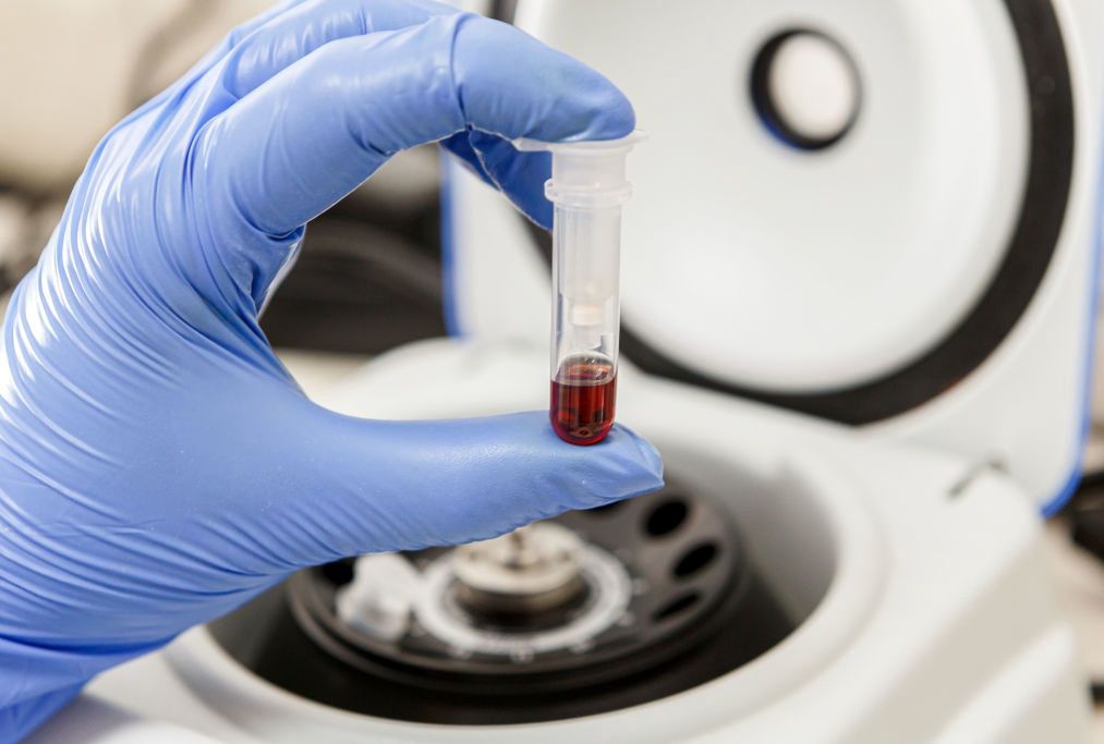 Bazocyty - czym są i jaką pełnią funkcję w organizmie?