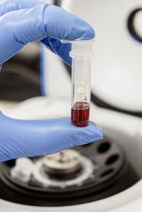 Bazocyty - czym są i jaką pełnią funkcję w organizmie?