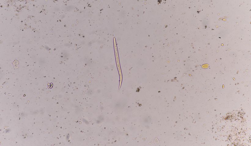 Czym są owsiki? | WP parenting