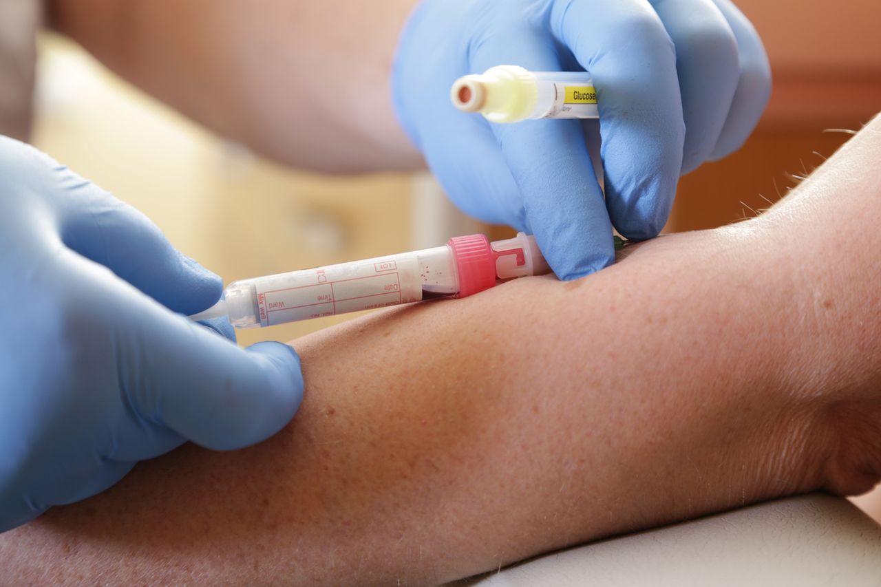 FibroTest - wskazania, przebieg, cena, interpretacja wyników, FibroMax