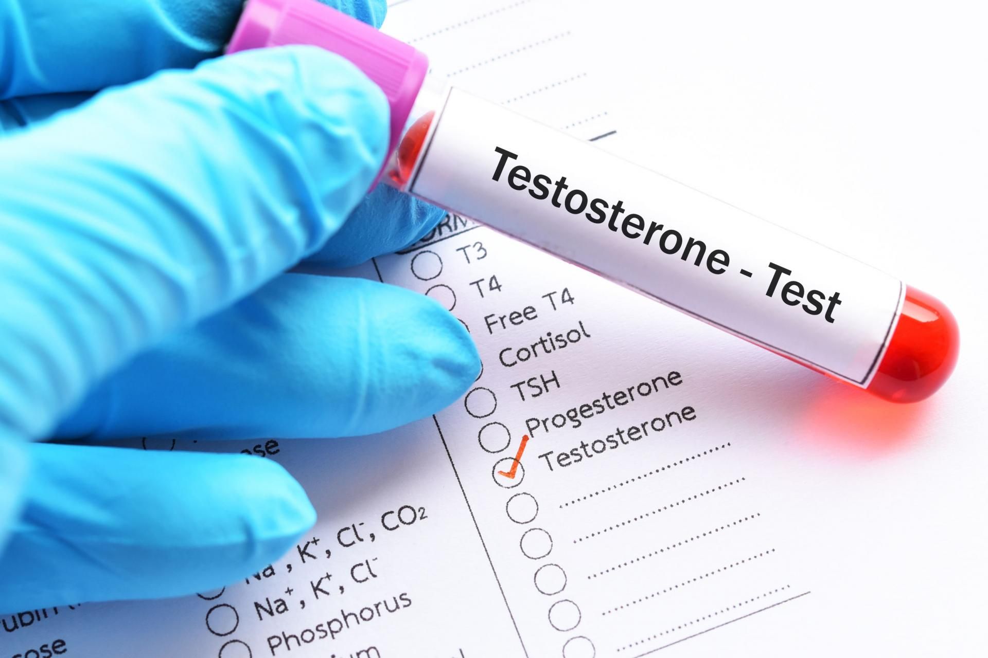 DHT, czyli dihydrotestosteron - charakterystyka, funkcje, niedobór i ...