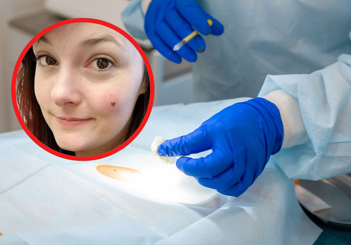 Miała na policzku pieprzyk w kształcie serca. Usłyszała druzgocącą ...