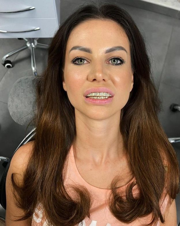 Rutkowski pokazała diamentowy uśmiech. Szokujące, jak wygląda - Pudelek